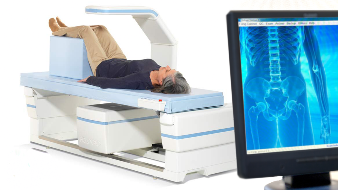 DENSITOMETRIA ÓSSEA, O QUE É E COMO REALIZAR O EXAME